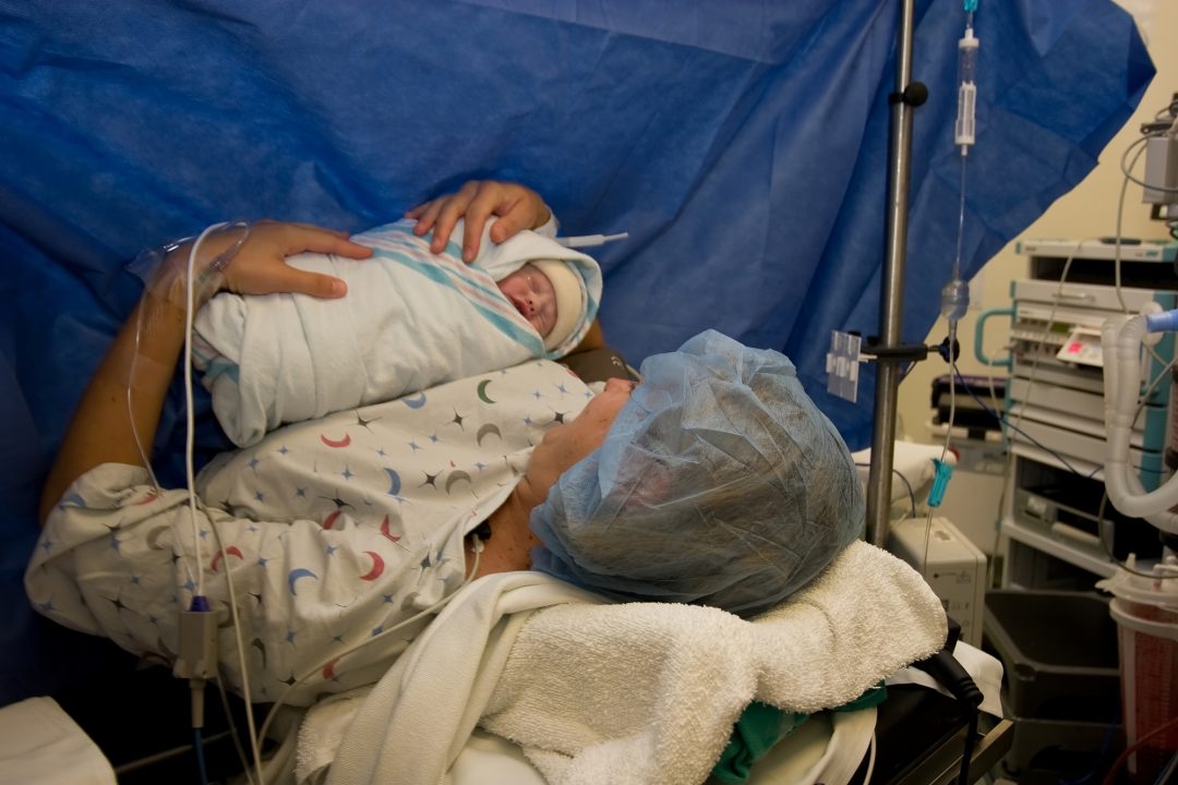 Preparing for a C-Section? Here's What You Need to Know | It's a Mother ...