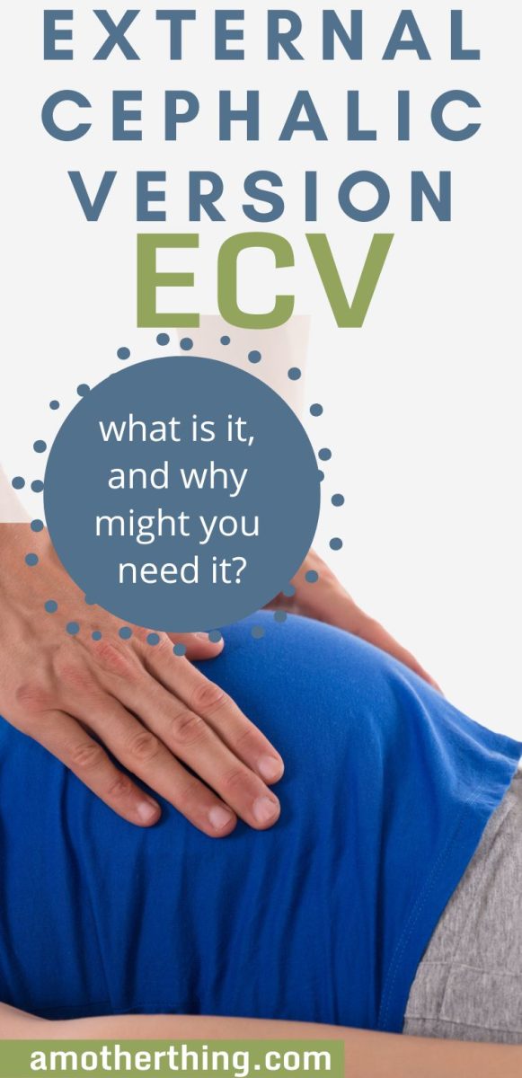 The Lowdown on External Cephalic Version (ECV) | It's a Mother Thing