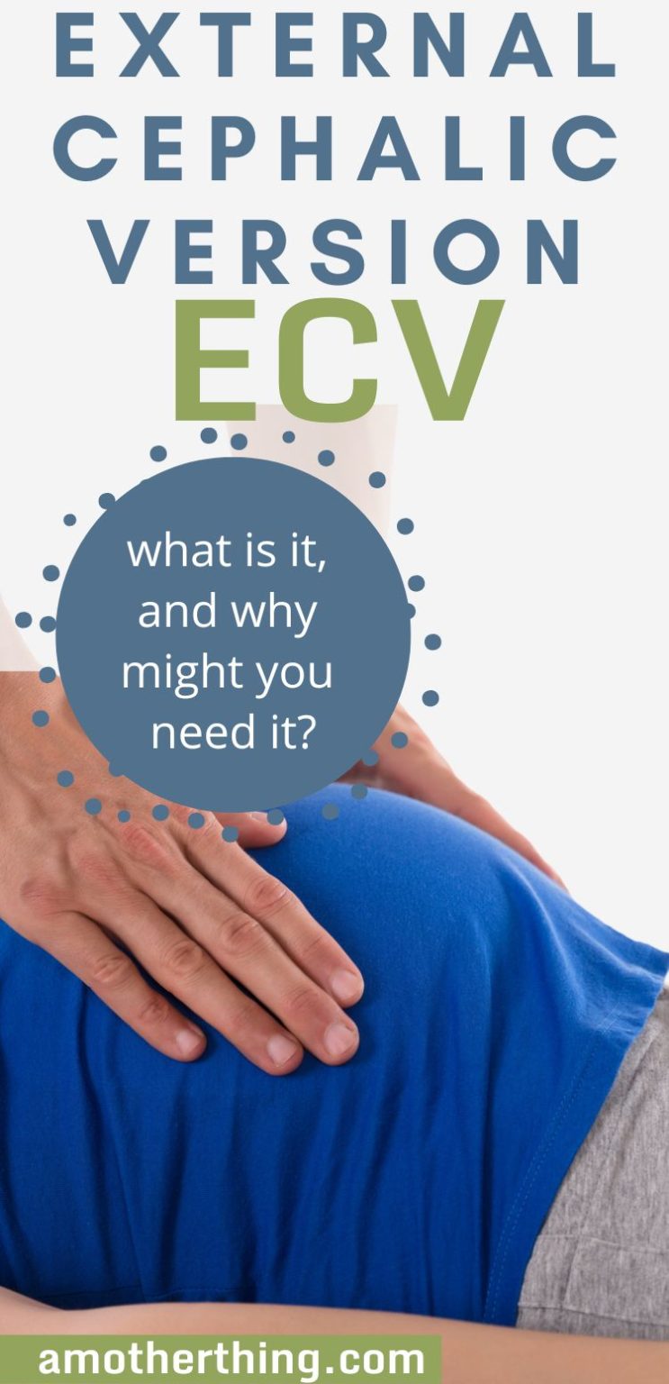 The Lowdown on External Cephalic Version (ECV) | It's a Mother Thing