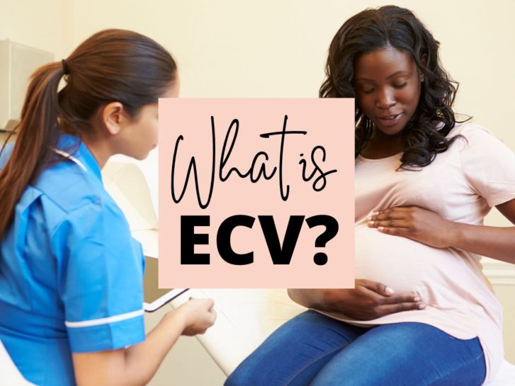 The Lowdown on External Cephalic Version (ECV) | It's a Mother Thing