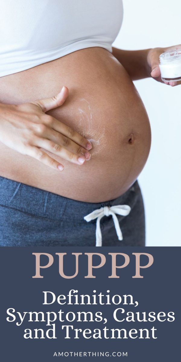 PUPPP Rash: Definition, Symptoms, Causes, & Treatment