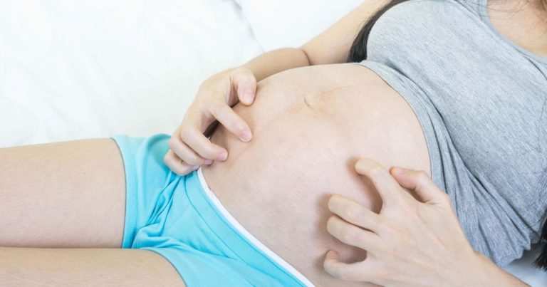 PUPPP Rash: Definition, Symptoms, Causes, & Treatment