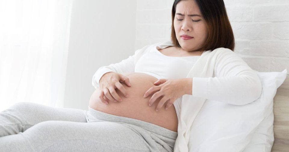 PUPPP Rash: Definition, Symptoms, Causes, & Treatment