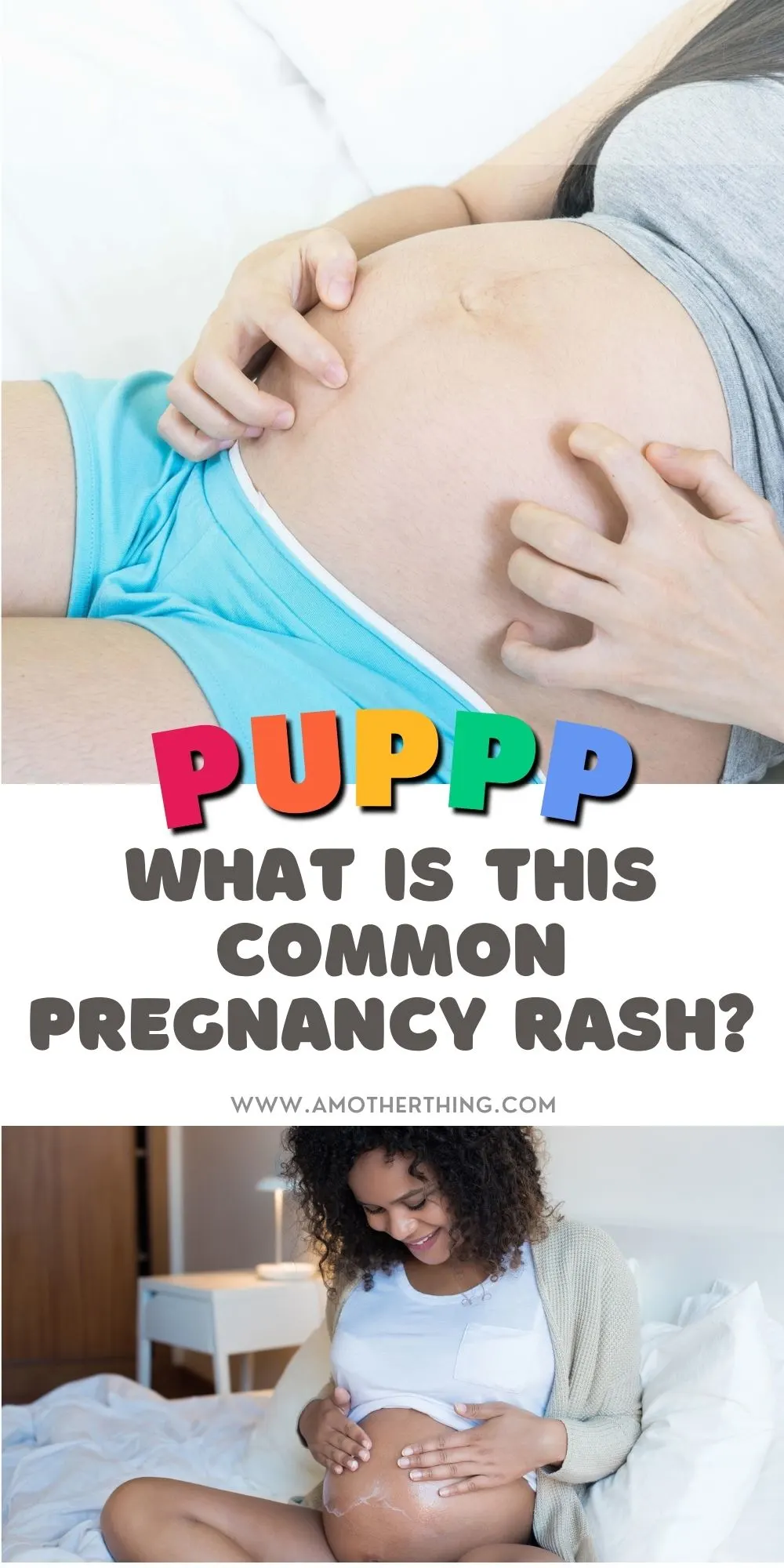 PUPPP Rash: Definition, Symptoms, Causes, & Treatment